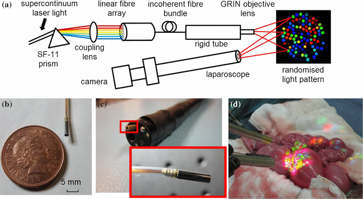 An endoscopic structured light system using multispectral detection ...