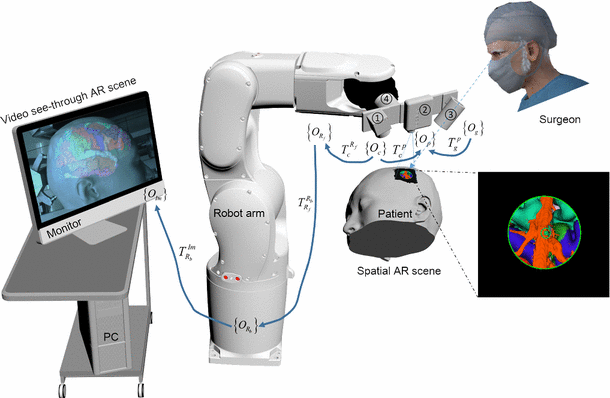 A surgical robot with augmented reality visualization for stereoelectroencephalography electrode ...