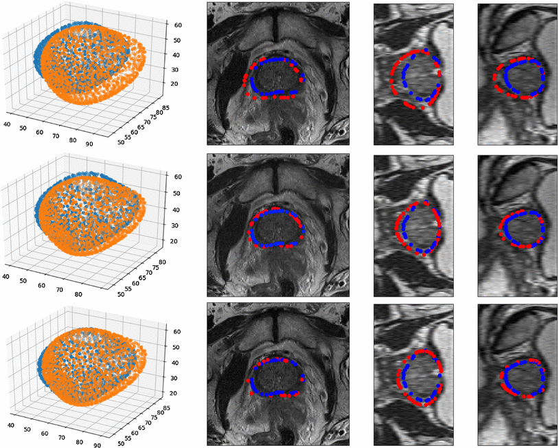 Prostate segmentation in MRI using a convolutional neural network architecture and training ...