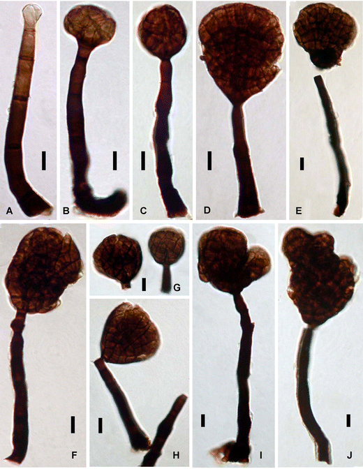 Acrodictys (Hyphomycetes) and related genera from China | SpringerLink