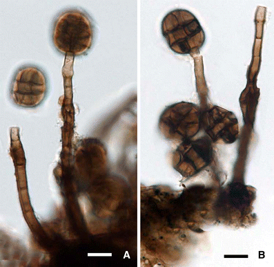 Acrodictys (Hyphomycetes) and related genera from China | SpringerLink