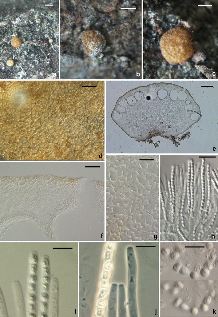 Trichoderma stromaticum and its overseas relatives | SpringerLink