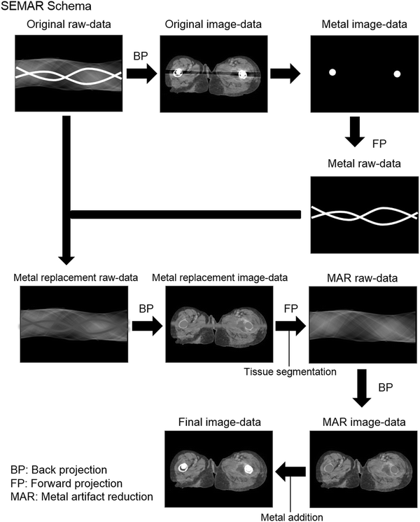 Single-energy metal artifact reduction for helical computed tomography ...