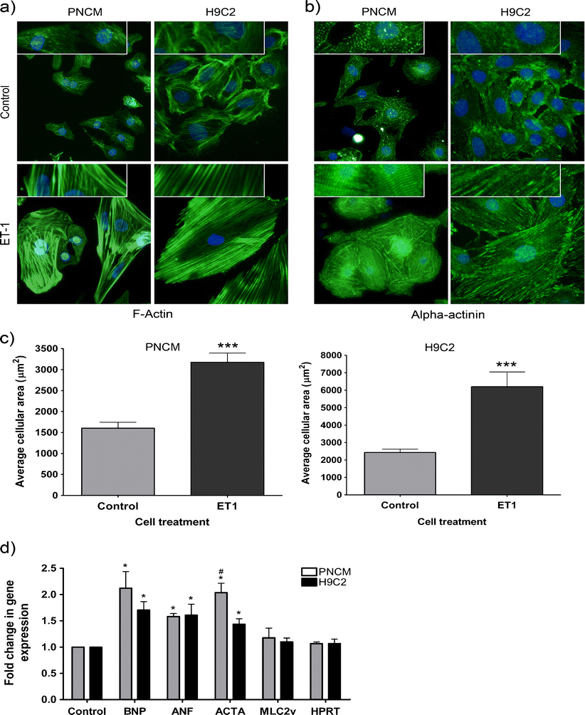 The H9C2 cell line and primary neonatal cardiomyocyte cells show similar hypertrophic responses ...