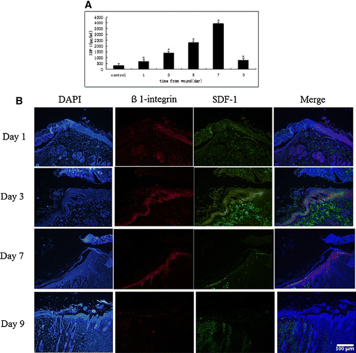 Stromal cell-derived factor 1 (SDF-1) accelerated skin wound healing by ...