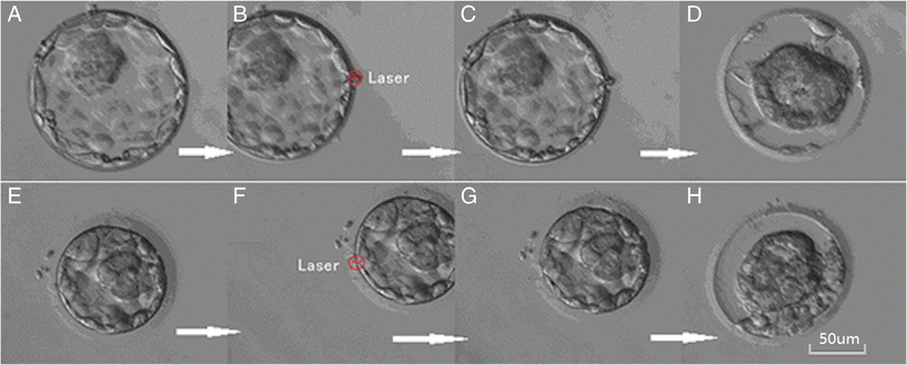 Comparison of vitrified outcomes between human early blastocysts and ...