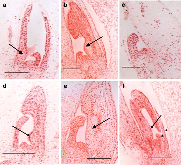Lilium candidum bulblet and meristem development | SpringerLink