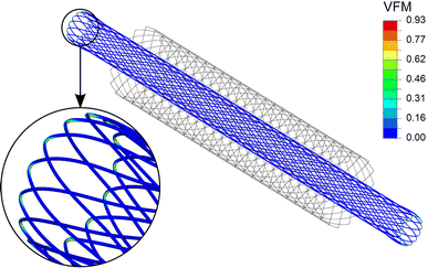 Simulations of Self-Expanding Braided Stent Using Macroscopic Model of ...