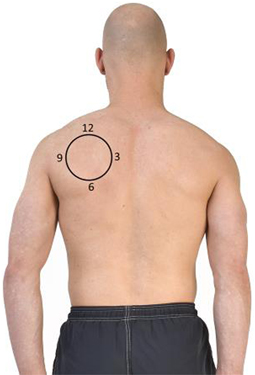 Effective rehabilitation in patients with scapular dyskinesis ...