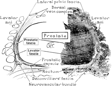 Athermal early retrograde release of the neurovascular bundle during ...