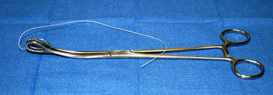 The Giep needle pass: a simple technique for the passage of needles for ...