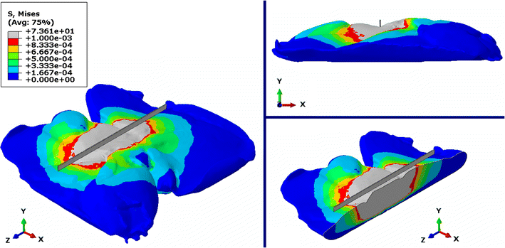 Toward high-speed 3D nonlinear soft tissue deformation simulations ...