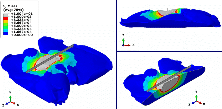 Toward high-speed 3D nonlinear soft tissue deformation simulations using Abaqus software ...