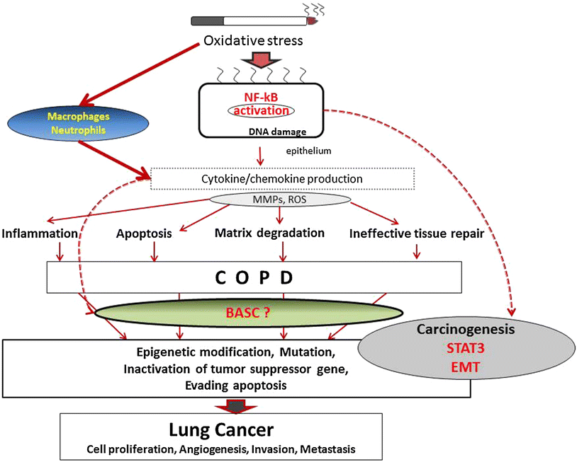 Lung carcinogenesis from chronic obstructive pulmonary disease ...