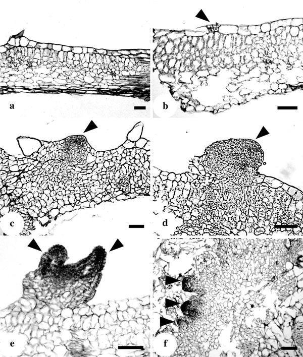 Plant regeneration via direct and indirect adventitious shoot formation ...