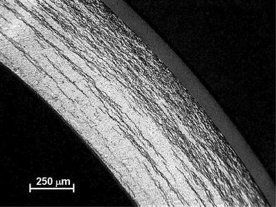 Hydride Formation in Zirconium Alloys | SpringerLink