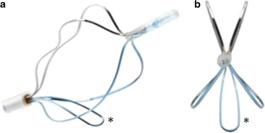 Meditate Temporary Implantable Nitinol Device | SpringerLink