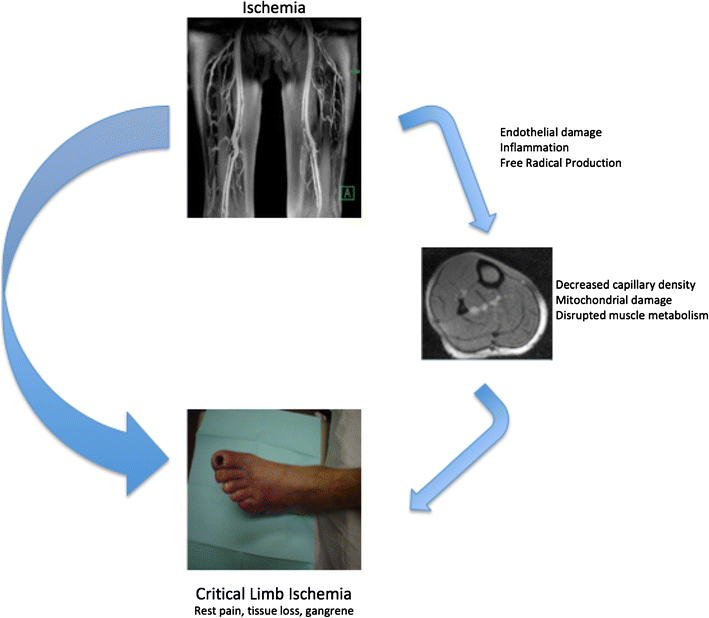 Limb Ischemia: Cardiovascular Diagnosis and Management from Head to Toe ...