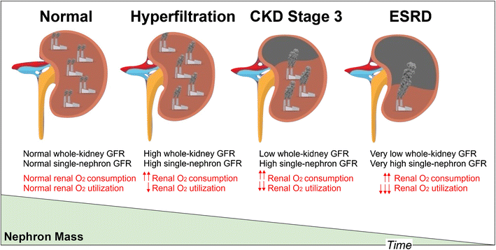 Renal Hyperfiltration in Adolescents with Type 2 Diabetes: Physiology ...