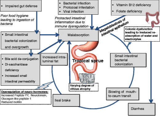 Tropical Sprue in 2014: the New Face of an Old Disease | SpringerLink