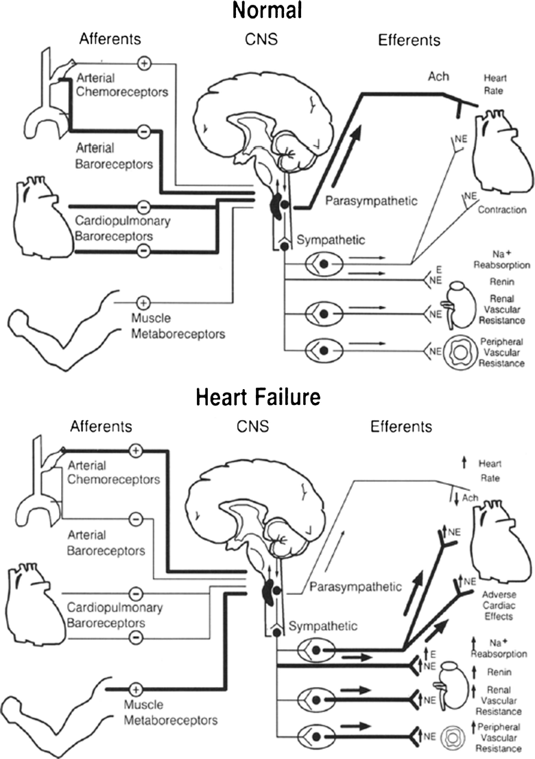 Autonomic Modulation With Baroreflex Activation Therapy in Heart Failure | SpringerLink