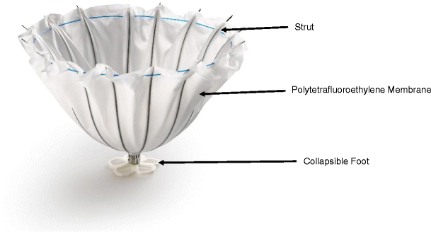 Percutaneous Ventricular Restoration with a Partitioning Device for ...