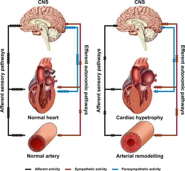 Cardiovascular Autonomic Dysfunction in Chronic Kidney Disease: a ...