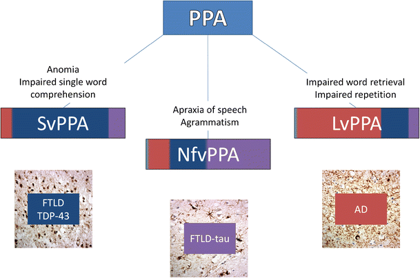 Pathology in Primary Progressive Aphasia Syndromes | SpringerLink