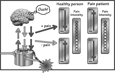 Altered Central Sensitization and Pain Modulation in the CNS in Chronic ...