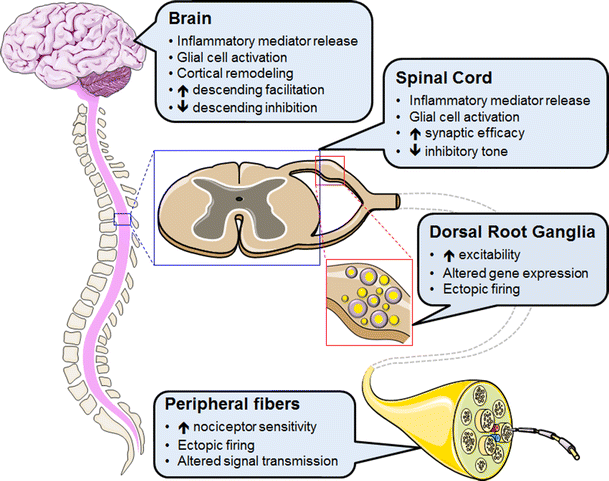 Neuropathic Pain: Central vs. Peripheral Mechanisms | SpringerLink