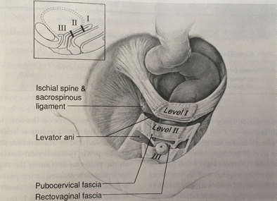 Hysterectomy in the Urologist’s Practice | SpringerLink