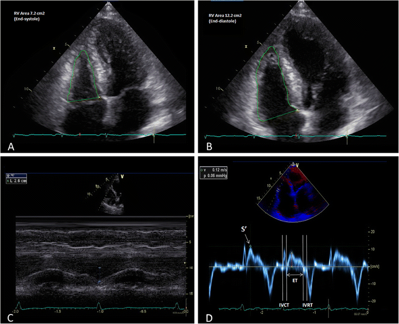 Assessment of Cardiac Function by Echocardiography | SpringerLink