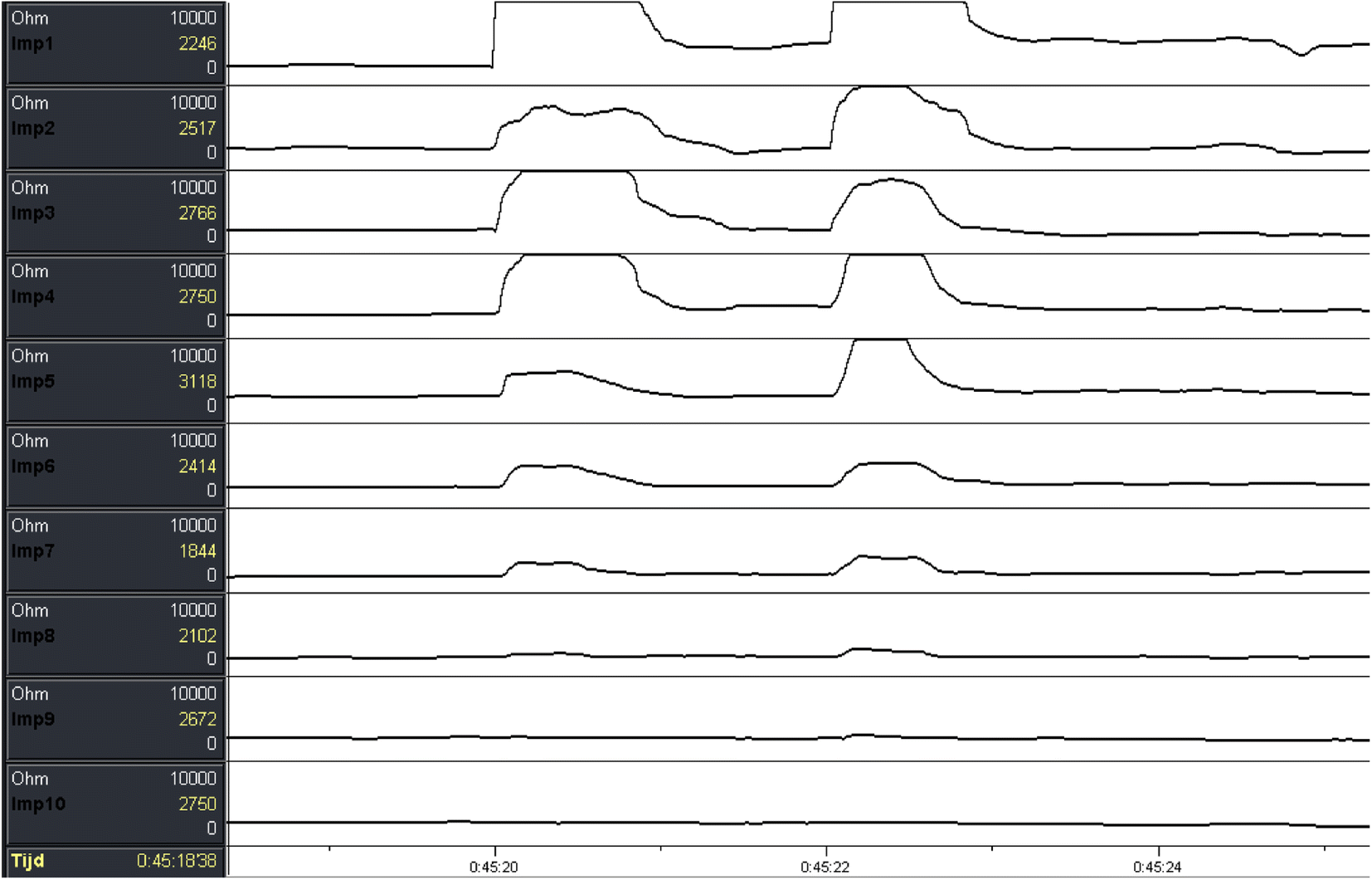 Chronic Burping and Belching | SpringerLink