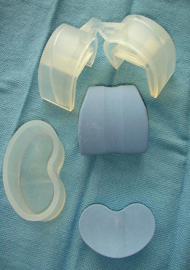 Intraoperative Molds to Create an Articulating Spacer for the Infected ...