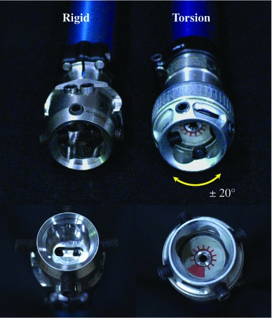 Does a Torsion Adapter Improve Functional Mobility, Pain, and Fatigue ...