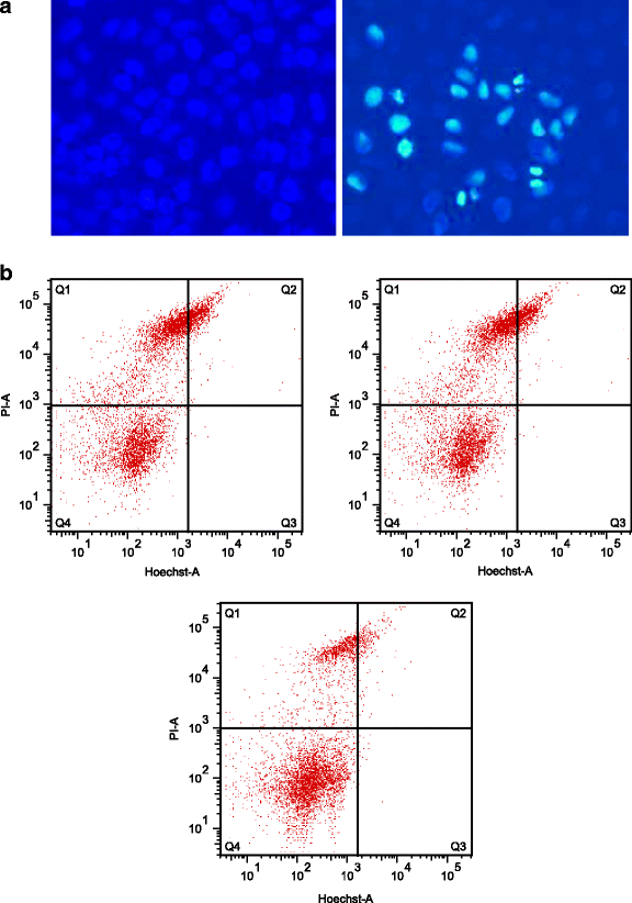 Sodium Selenite-Induced Apoptosis Mediated by ROS Attack in Human ...