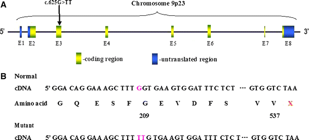 Oculocutaneous Albinism Type 3 (OCA3): Analysis of Two Novel Mutations ...