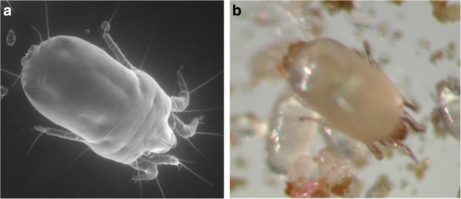 The Role of Dust Mites in Allergy | SpringerLink