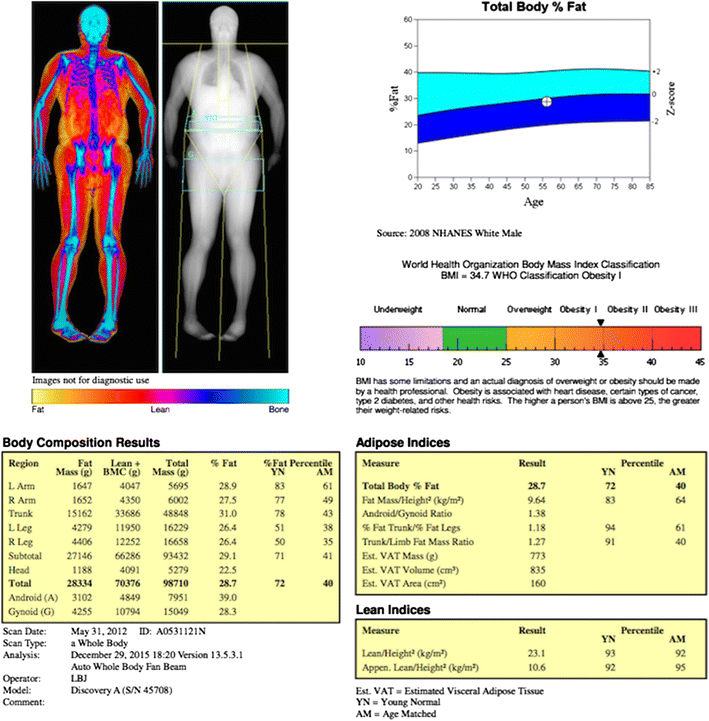 Evaluation of Sarcopenia by DXA | SpringerLink