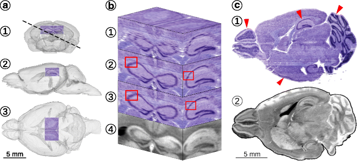 Possum—A Framework for Three-Dimensional Reconstruction of Brain Images ...