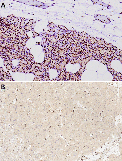 Immunohistochemistry in Diagnostic Parathyroid Pathology | SpringerLink