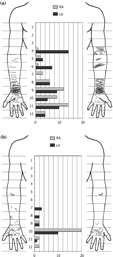 Suicidal and homicidal sharp force injury: a 5-year retrospective ...
