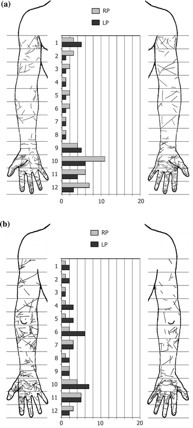 Suicidal and homicidal sharp force injury: a 5-year retrospective ...