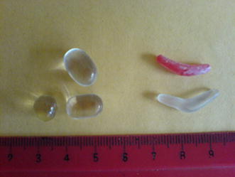 Penile pearls: a westward traveling phenomenon | SpringerLink