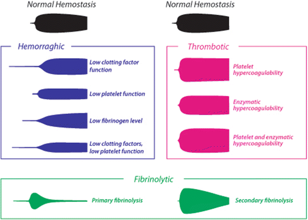 Review of Thromboelastography in Neurocritical Care | SpringerLink