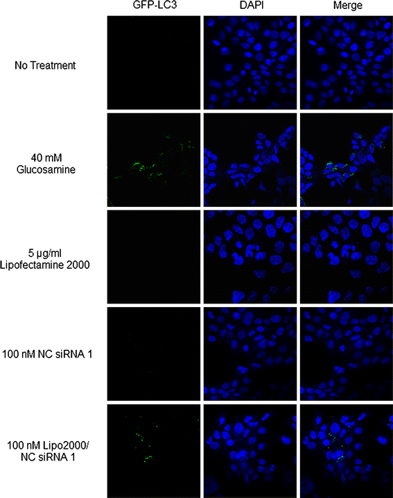 Effects of Lipofectamine 2000/siRNA Complexes on Autophagy in Hepatoma ...