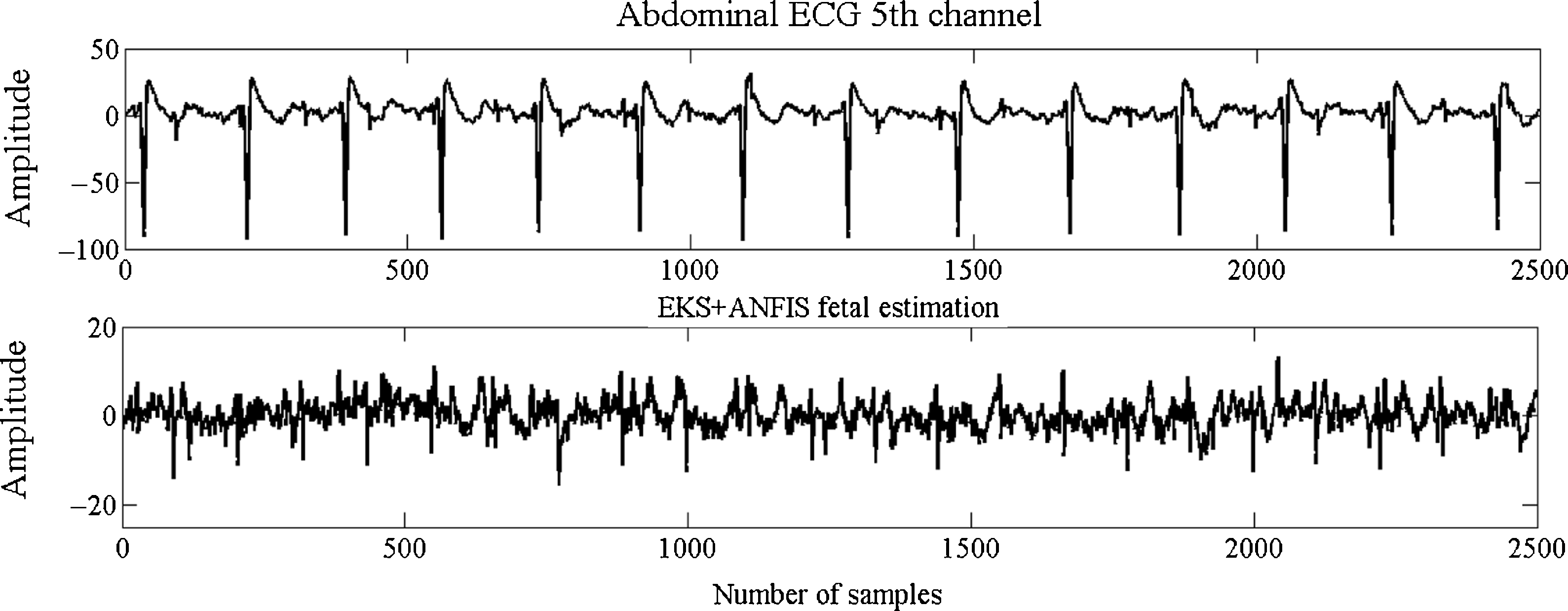 Extraction Of Fetal Electrocardiogram Ecg By Extended State Kalman