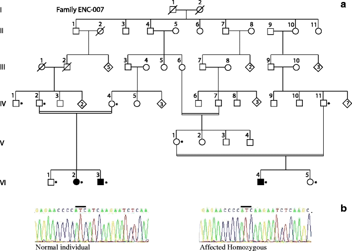 CLN6 p.I154del Mutation Causing Late Infantile Neuronal Ceroid ...