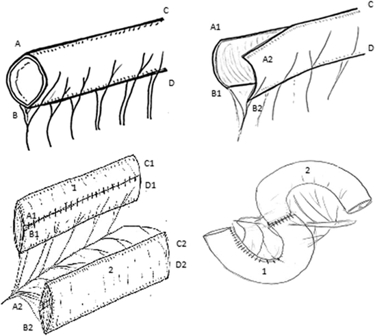 Intestinal Failure in Children | SpringerLink