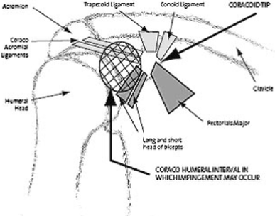 Coracoid impingement syndrome: a literature review | SpringerLink